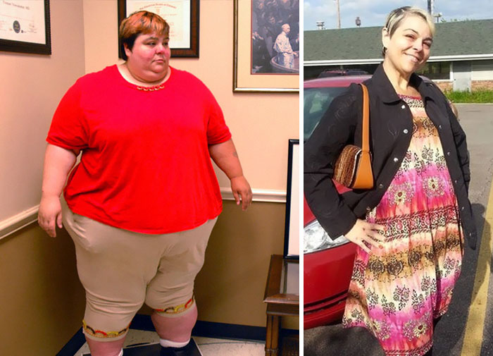 Here s Where These My 600 Pound Life Participants Are Today Sizzlfy